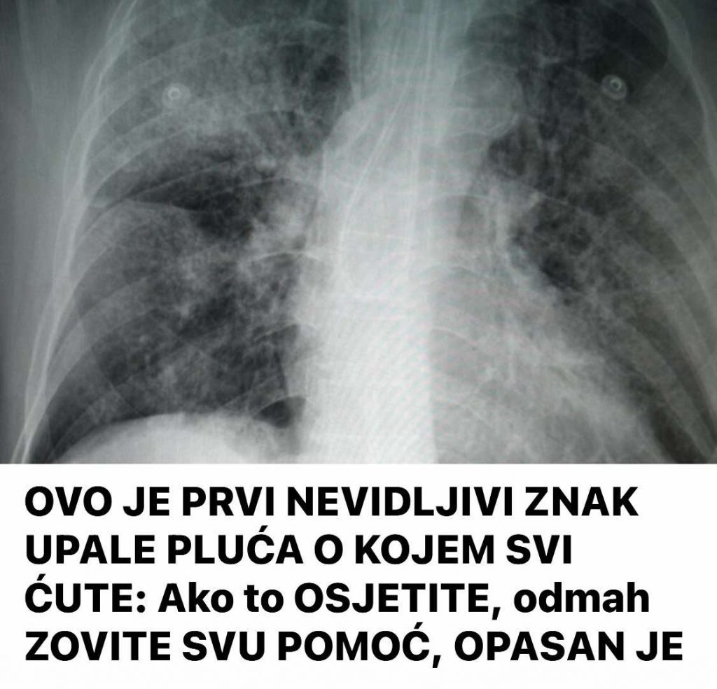 OVO JE PRVI NEVIDLJIVI ZNAK UPALE PLUĆA O KOJEM SVI ĆUTE: Ako to ...